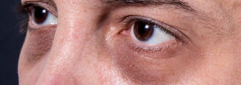 Platelet-rich Plasma Treatments at PRP Treatment Beverly Hills in CA