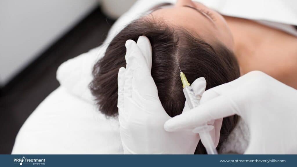 All You Need To Know About ECM PRP Injection For Hair Regeneration