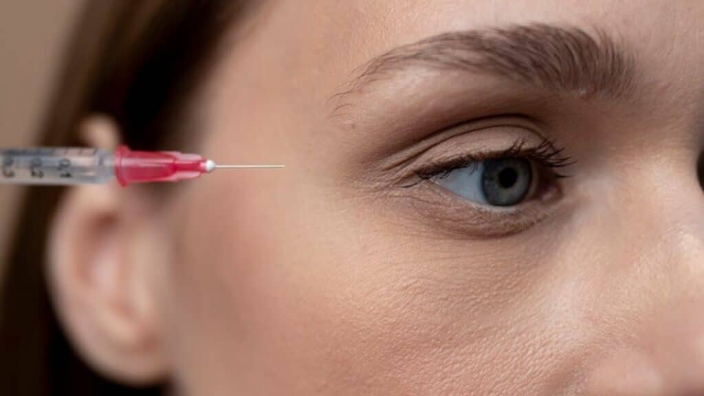 PRP Under Eyes Before And After Queries | PRP Treatment